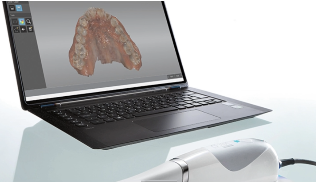 SCANNER INTRAORALE UN'ALTRA TECNOLOGIA DI UN MODERNO STUDIO ...